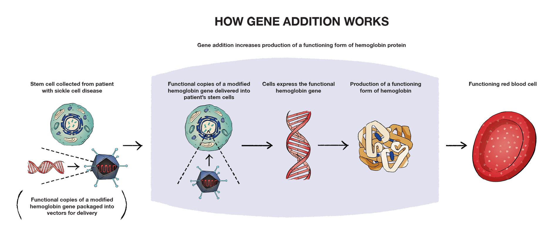 Gene Therapy In Sickle Cell | Raising Hope International Friends ...